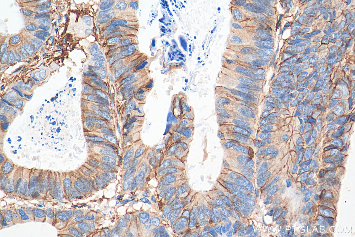 CD44 antibody (15675-1-AP) | Proteintech