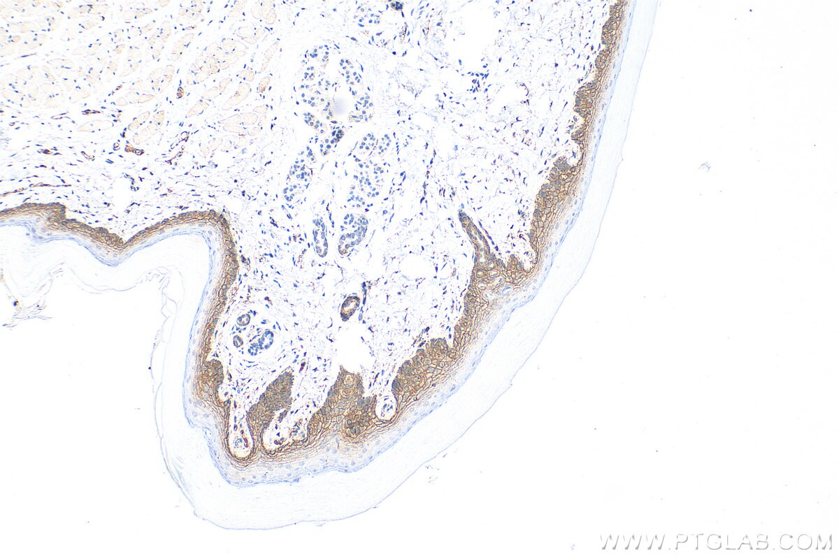 CD44 antibody (15675-1-AP) | Proteintech