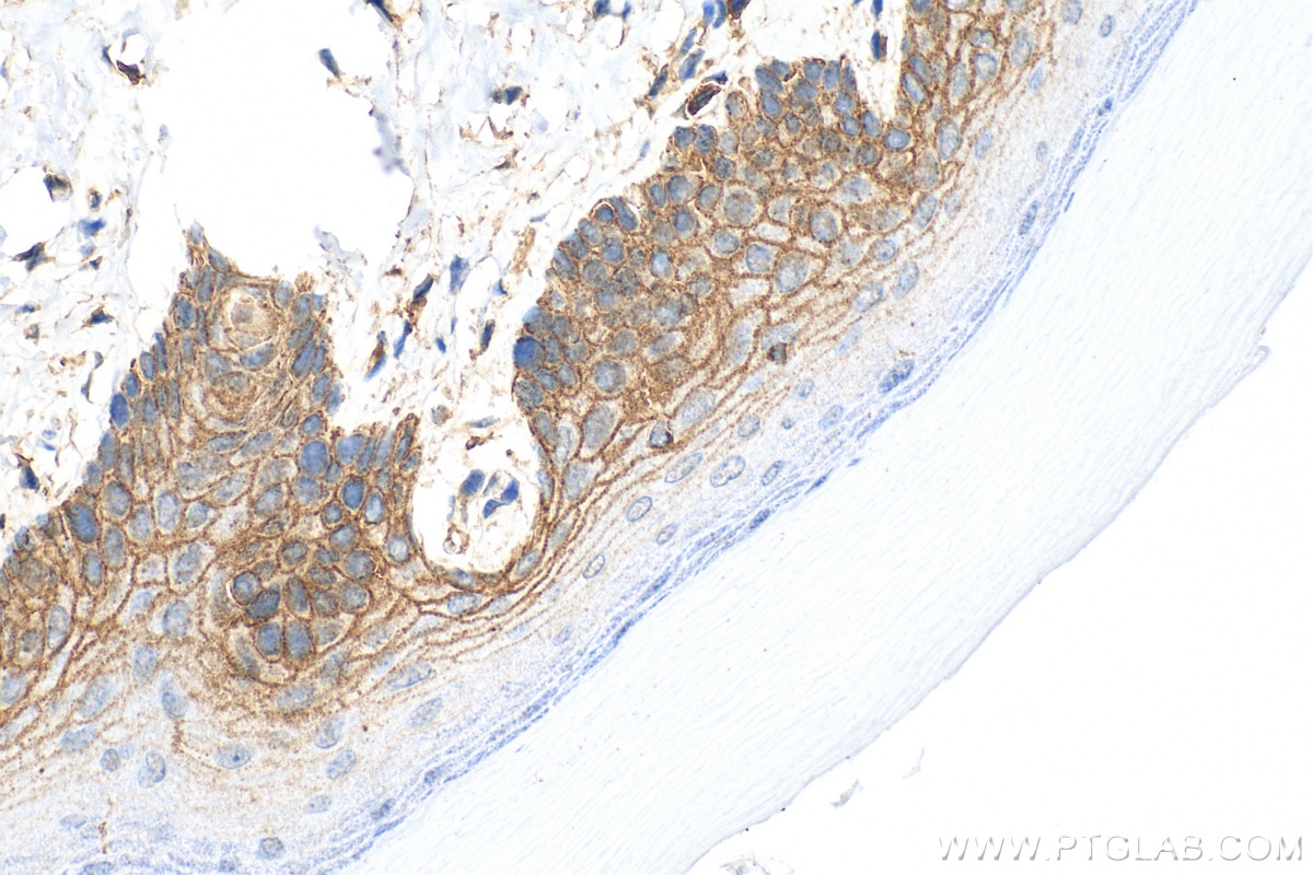CD44 antibody (15675-1-AP) | Proteintech