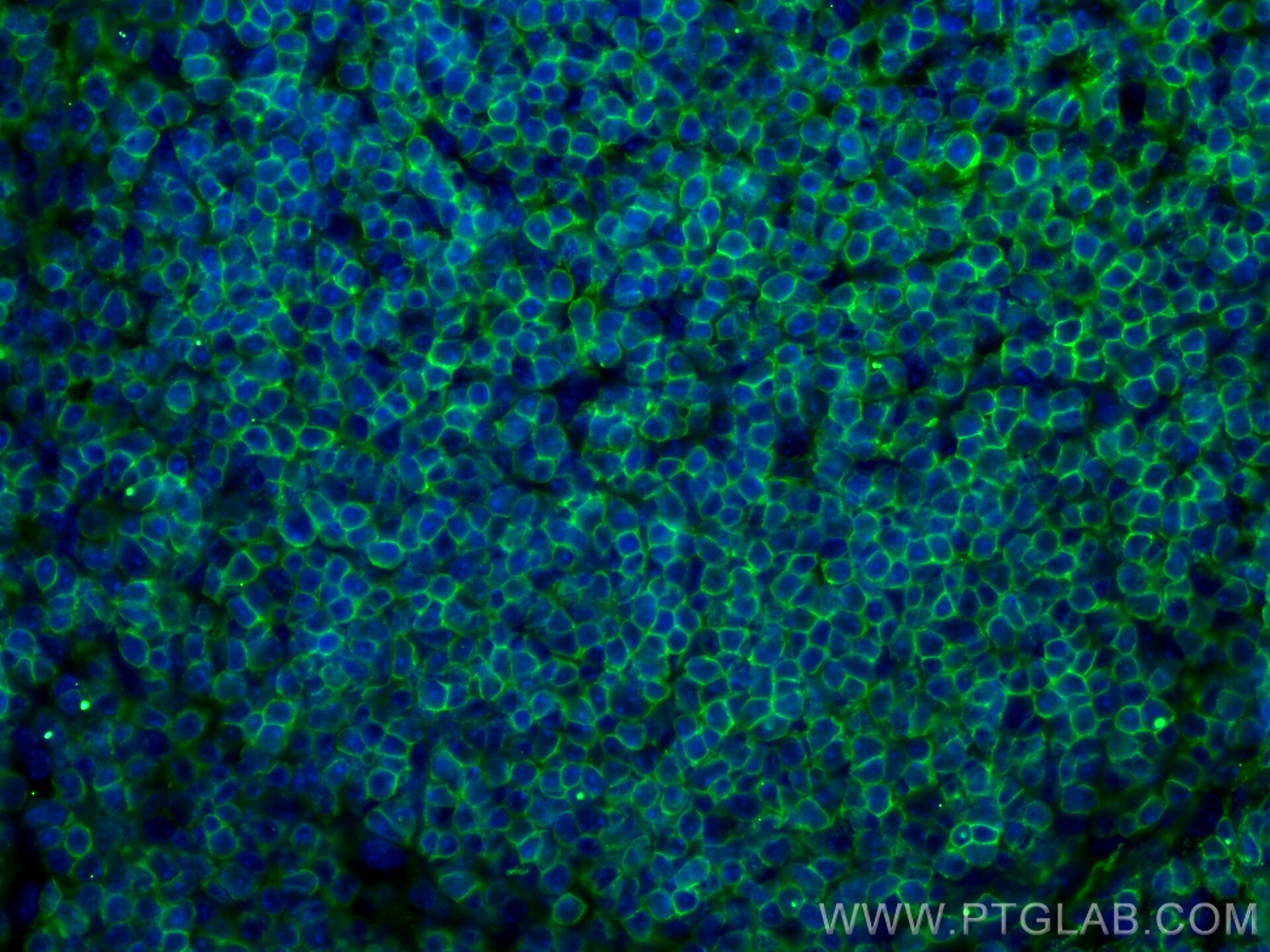 CD45 antibody (80297-1-RR) | Proteintech