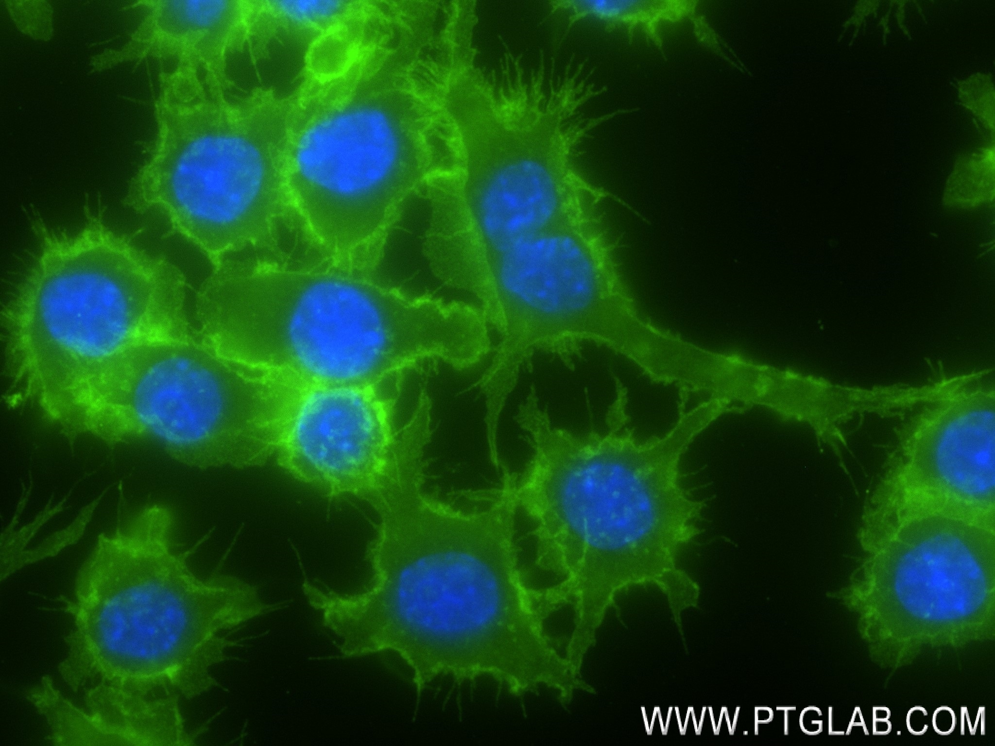 CD45 antibody (83396-11-RR) | Proteintech