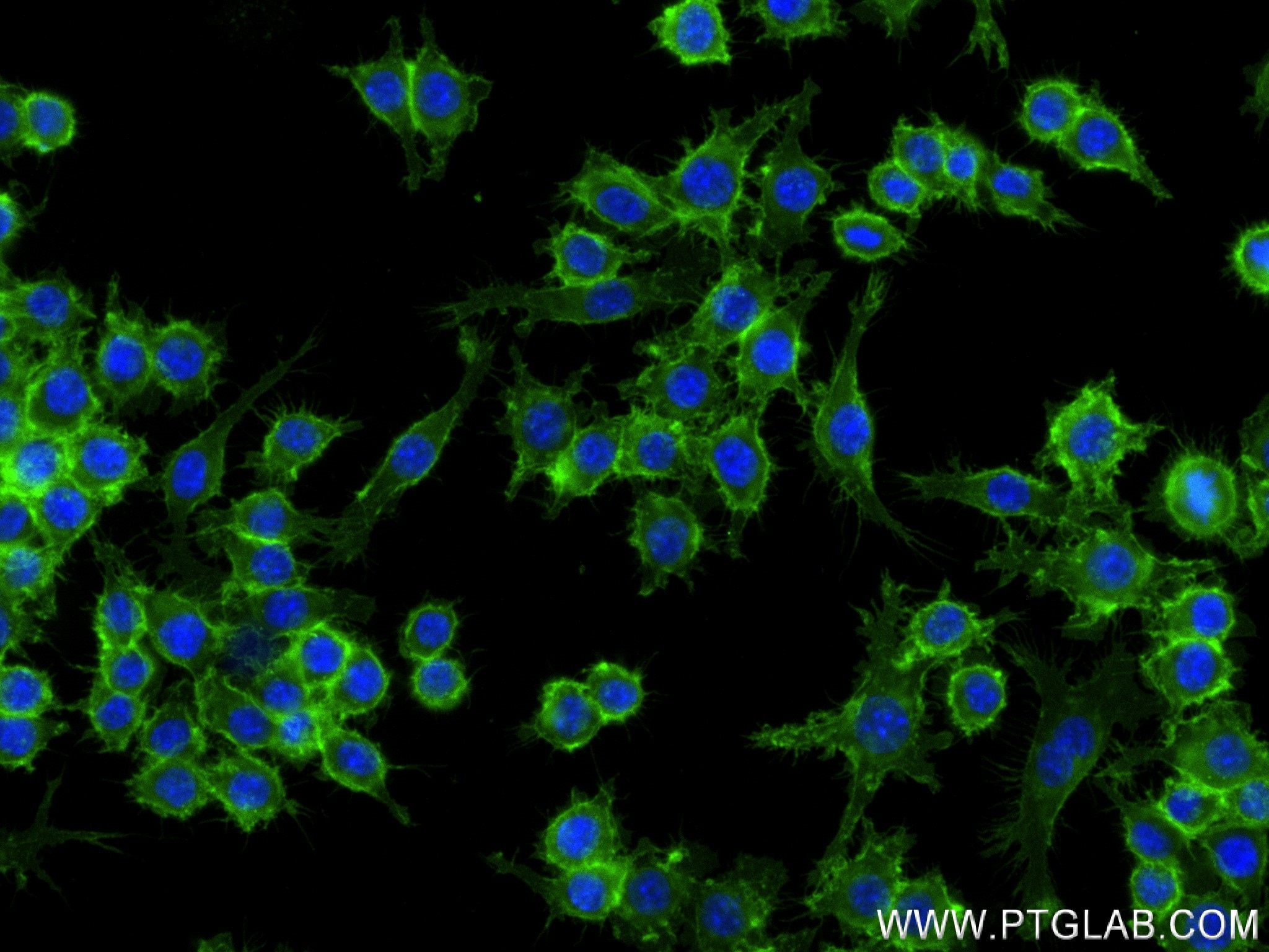 CD45 antibody (83396-11-RR) | Proteintech