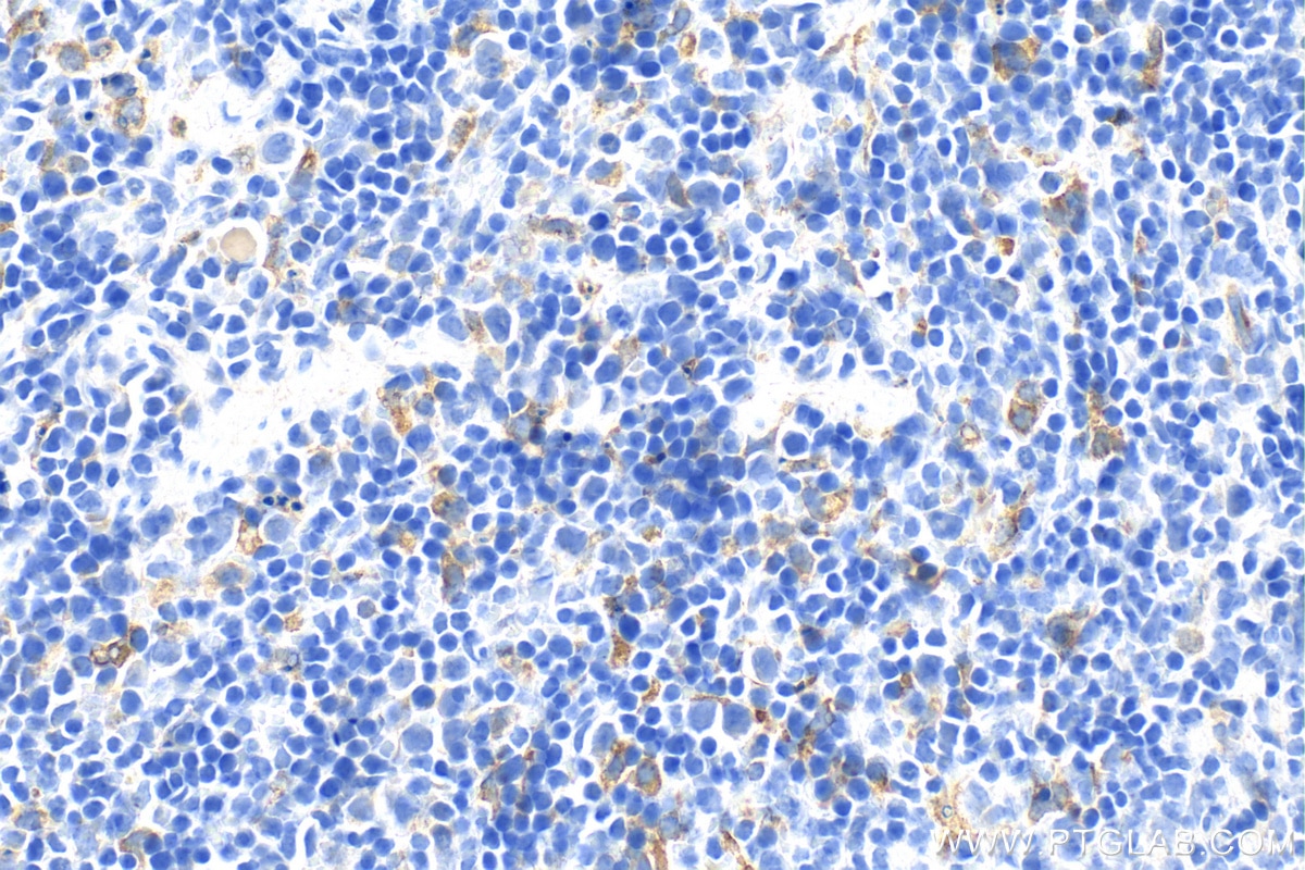 CD5L antibody (32626-1-AP) | Proteintech