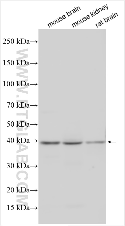 CD63 antibody (32604-1-AP) | Proteintech