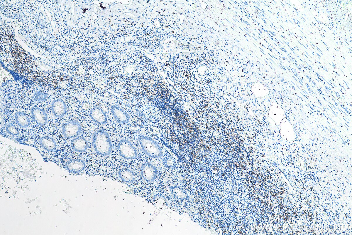 CD7 antibody (60209-2-Ig) | Proteintech