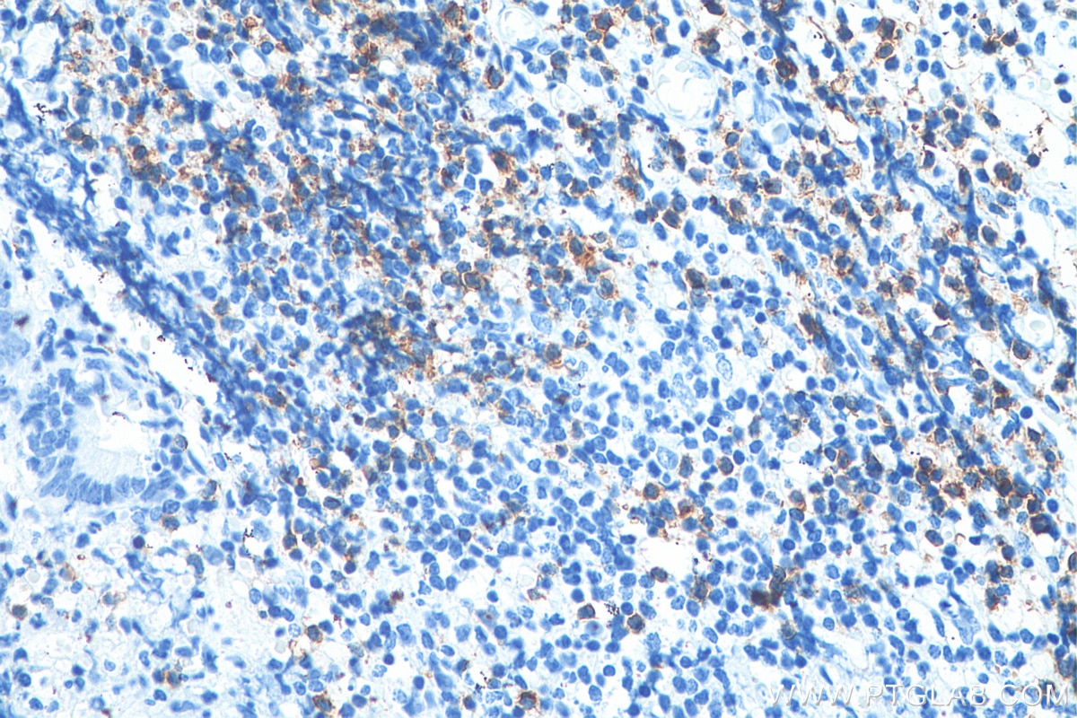 CD7 antibody (60209-2-Ig) | Proteintech