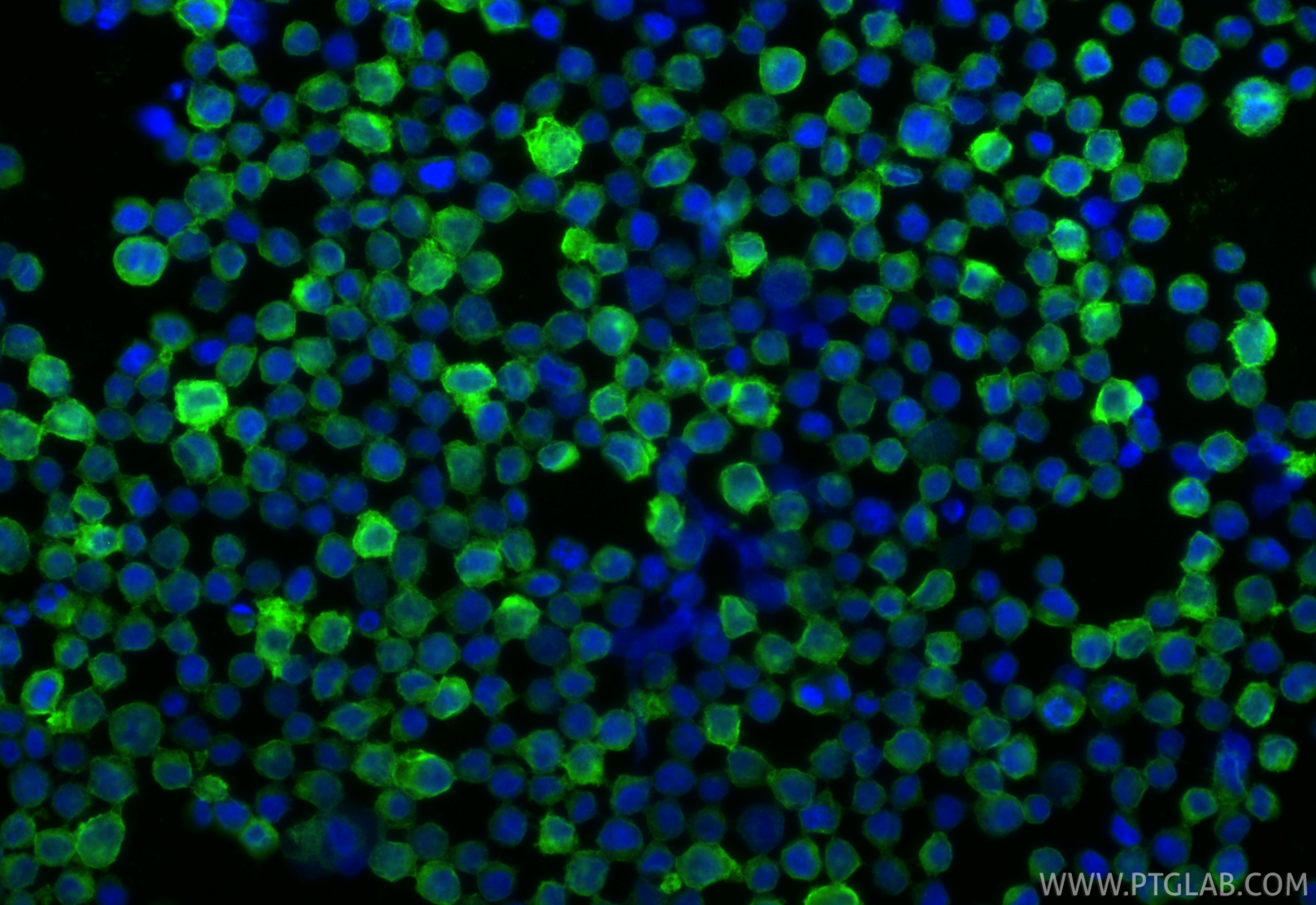 CD86 antibody (RMX00027) | Proteintech