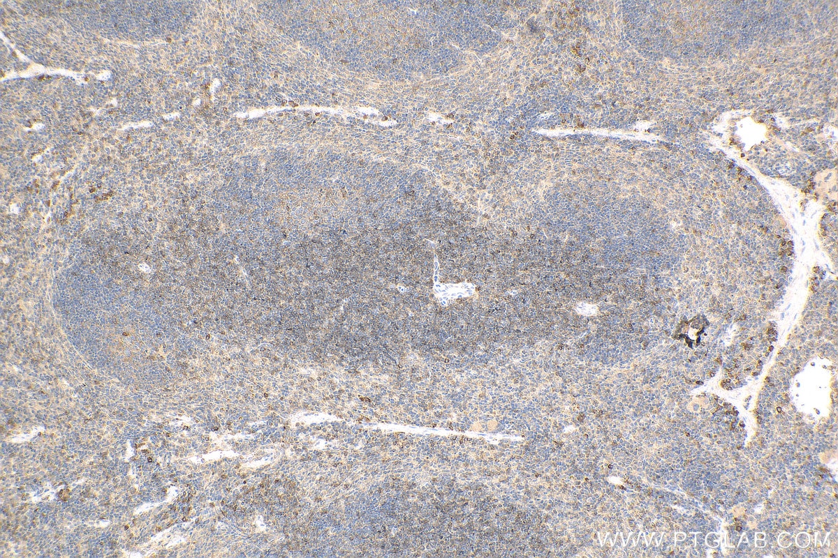 CD90 / Thy1 antibody (27178-1-AP) | Proteintech