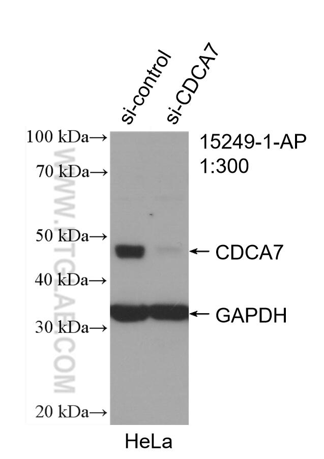 CDCA7 antibody (15249-1-AP) | Proteintech