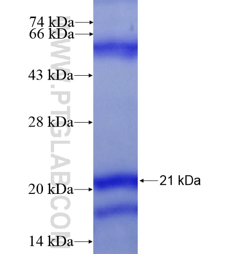 CDKN2B Fusion Protein Ag16059 | Proteintech
