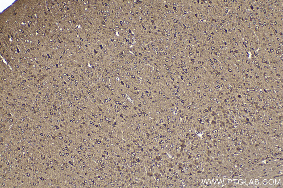 CDS2 antibody (28407-1-AP) | Proteintech
