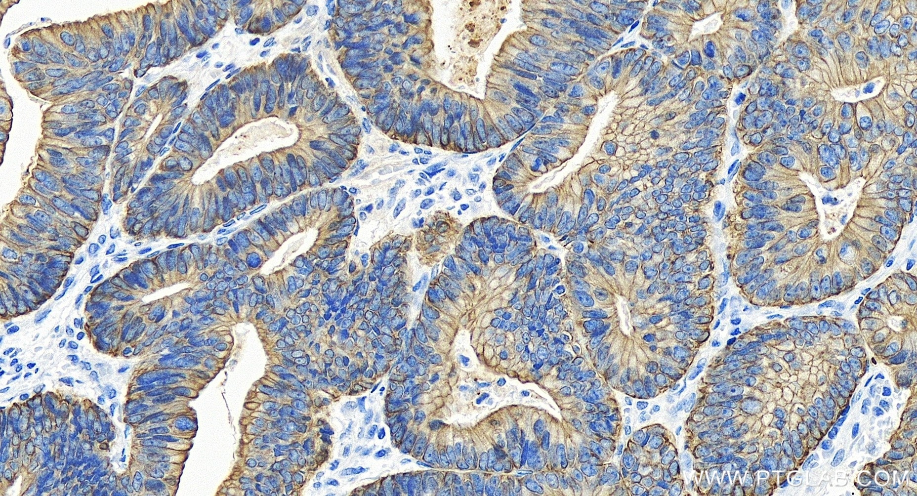 CEACAM6/CD66c antibody (84982-1-RR) | Proteintech