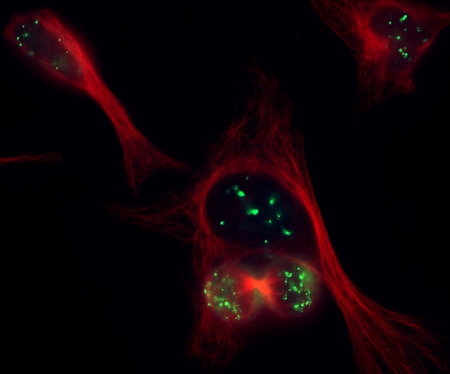 CENP-B antibody (pAb) | Proteintech