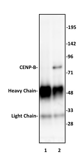 CENP-B antibody (pAb) | Proteintech