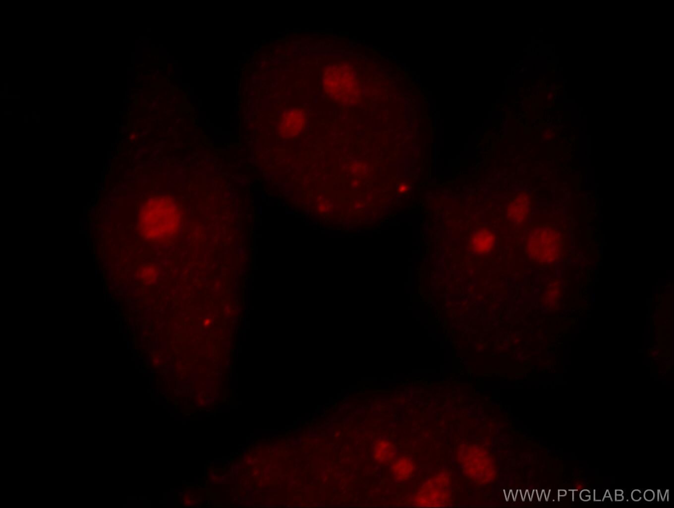 CEP192 Fusion Protein Ag29930 | Proteintech
