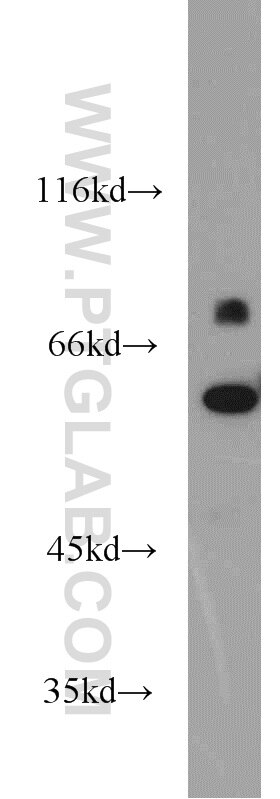 CHMP7 Fusion Protein Ag9641 | Proteintech