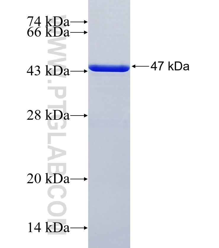 CIC Fusion Protein Ag35408 | Proteintech