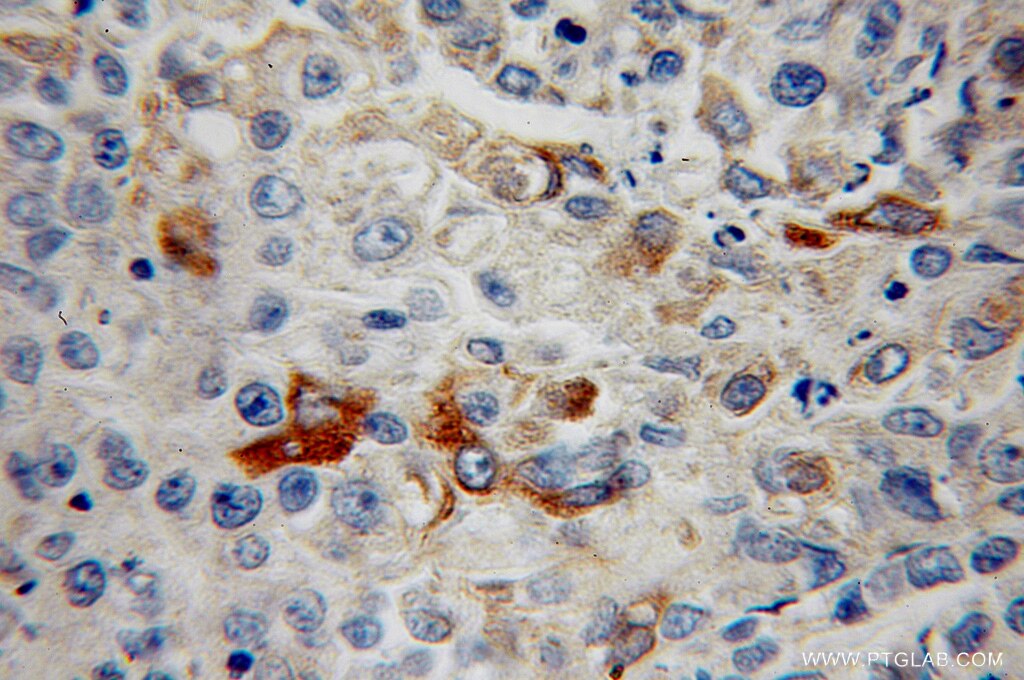 CLGN Fusion Protein Ag3322 | Proteintech