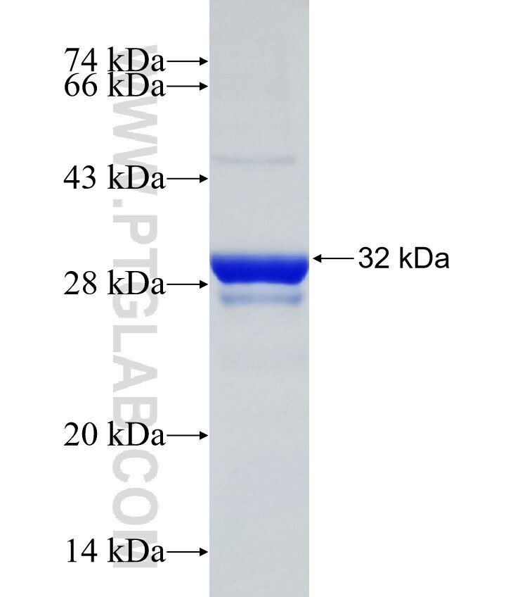 CLN3 Fusion Protein Ag31784 | Proteintech