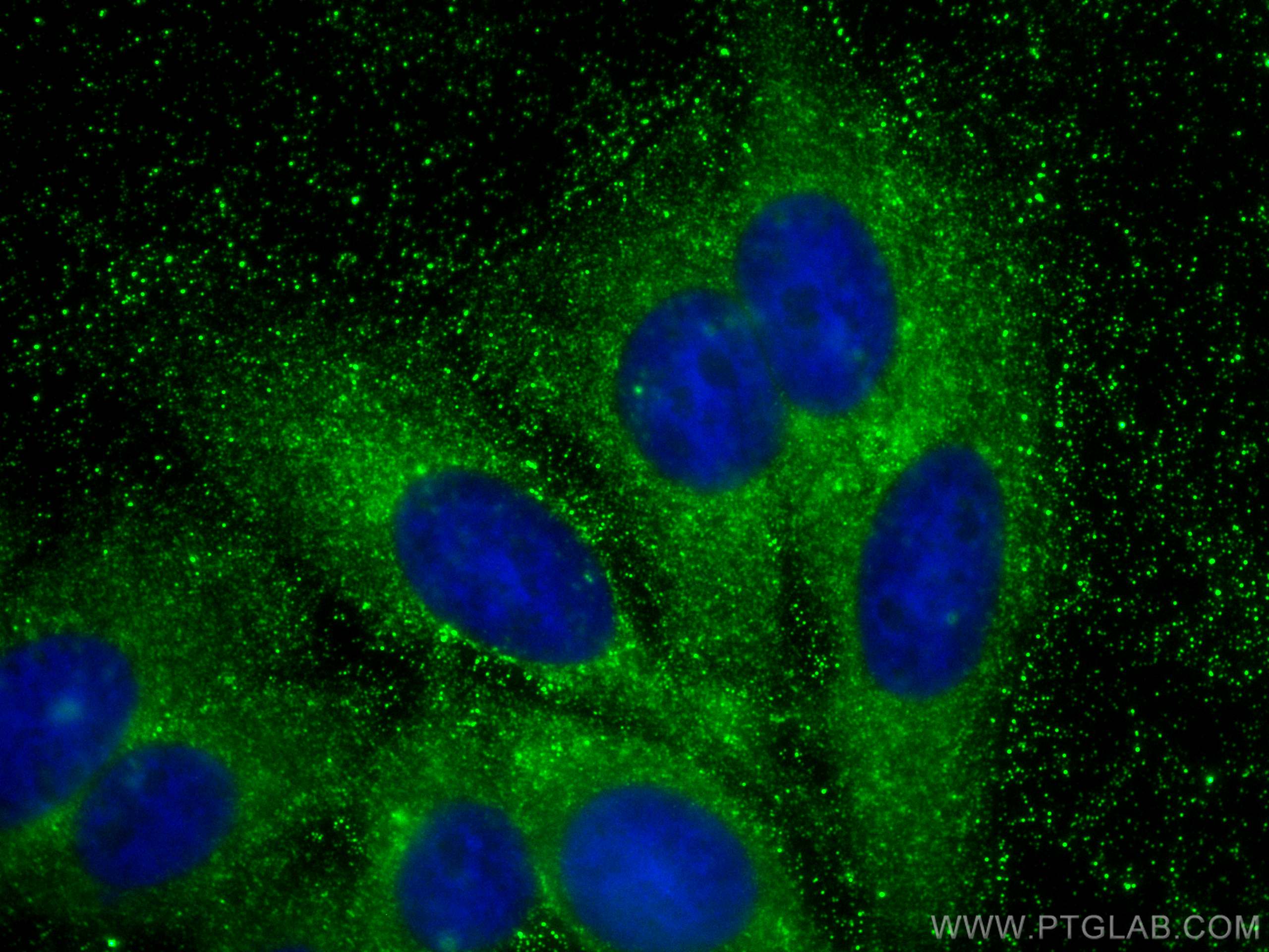 CLTC antibody (66487-1-PBS) | Proteintech