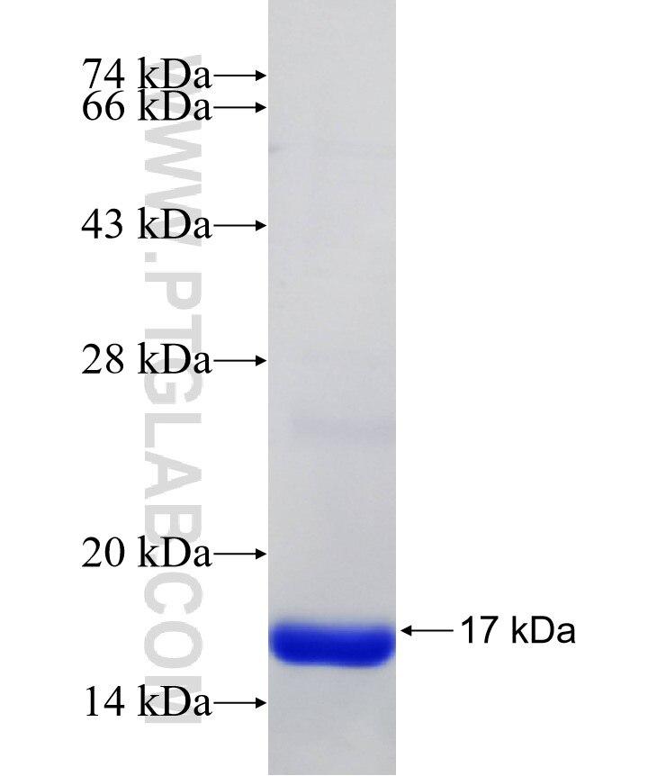 CNR1 Fusion Protein Ag31939 | Proteintech