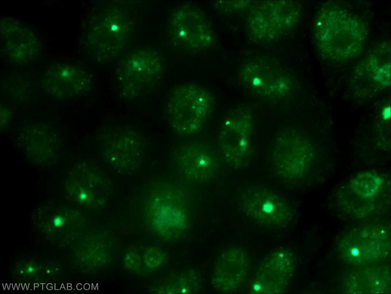 Coilin antibody (10967-1-AP) | Proteintech