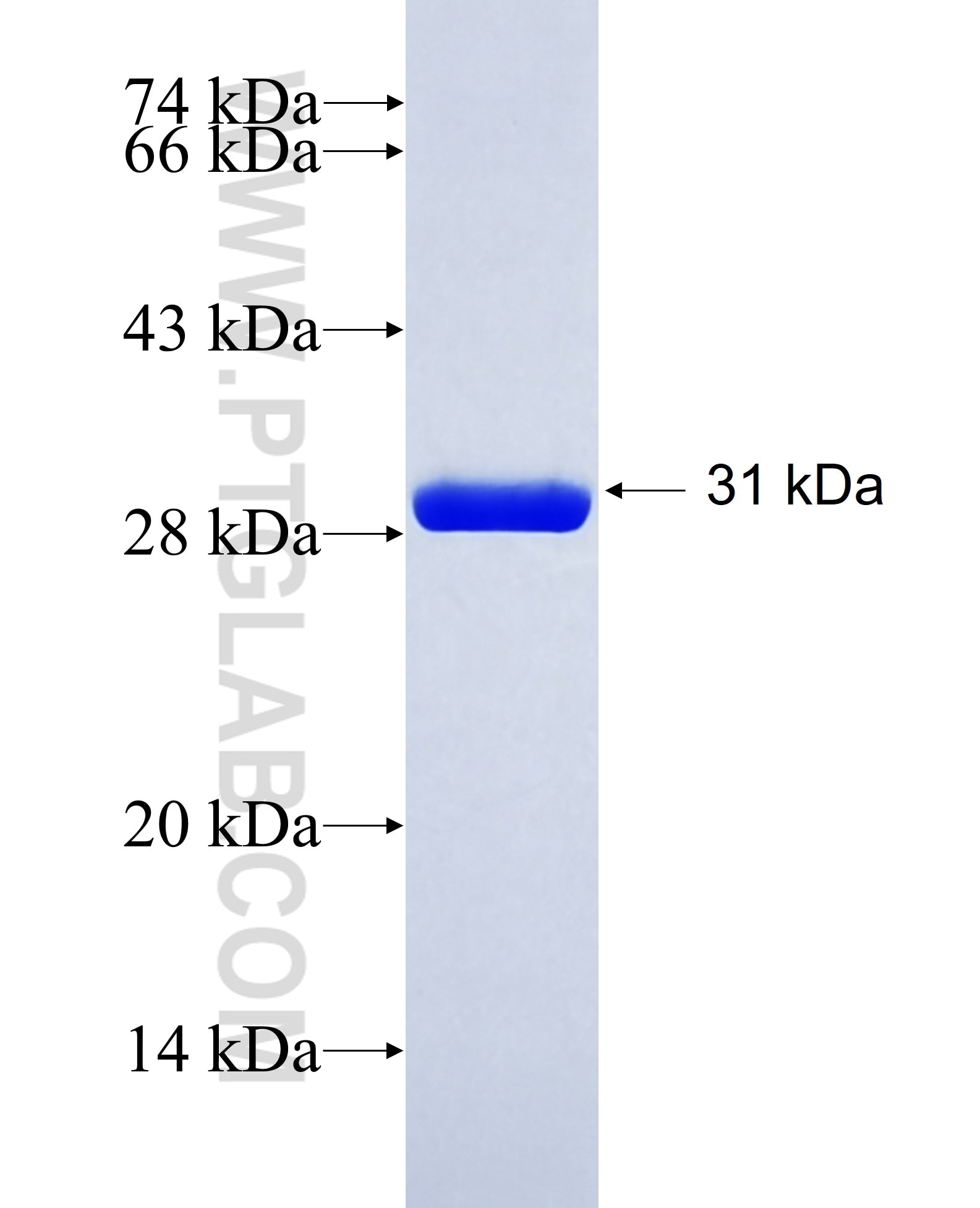 COL6A3 Fusion Protein Ag35162 | Proteintech