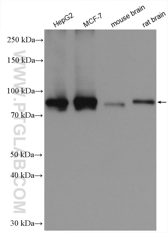 CPT1A antibody (15184-1-AP) | Proteintech