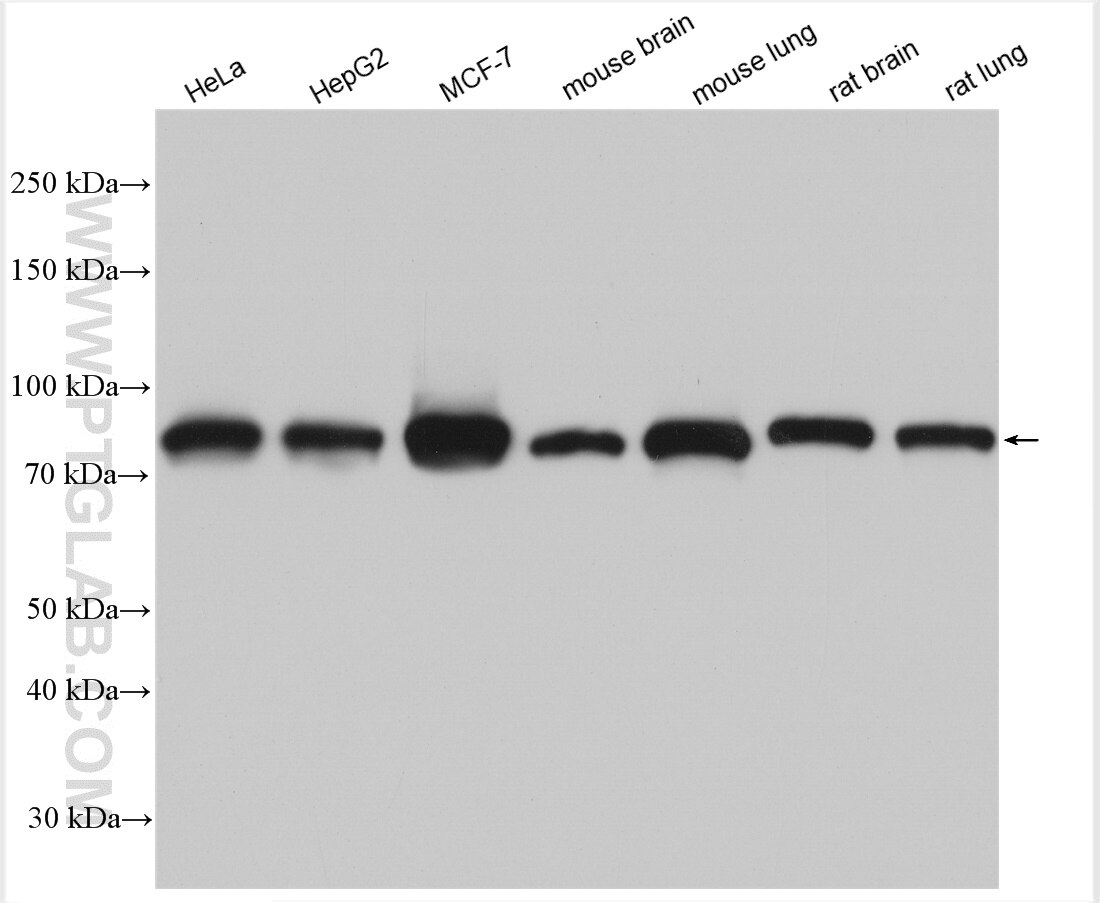 CPT1A antibody (15184-1-AP) | Proteintech