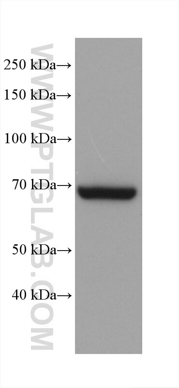 CPT2 antibody (68815-3-Ig) | Proteintech