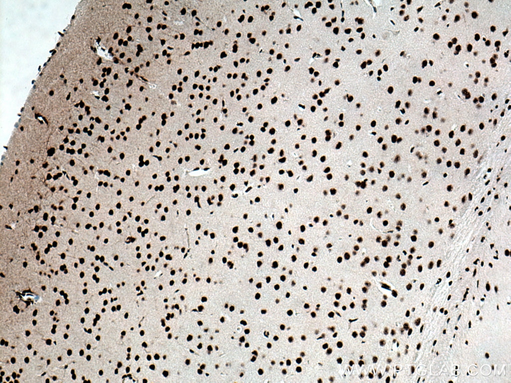 CREB1 antibody (12208-1-AP) | Proteintech