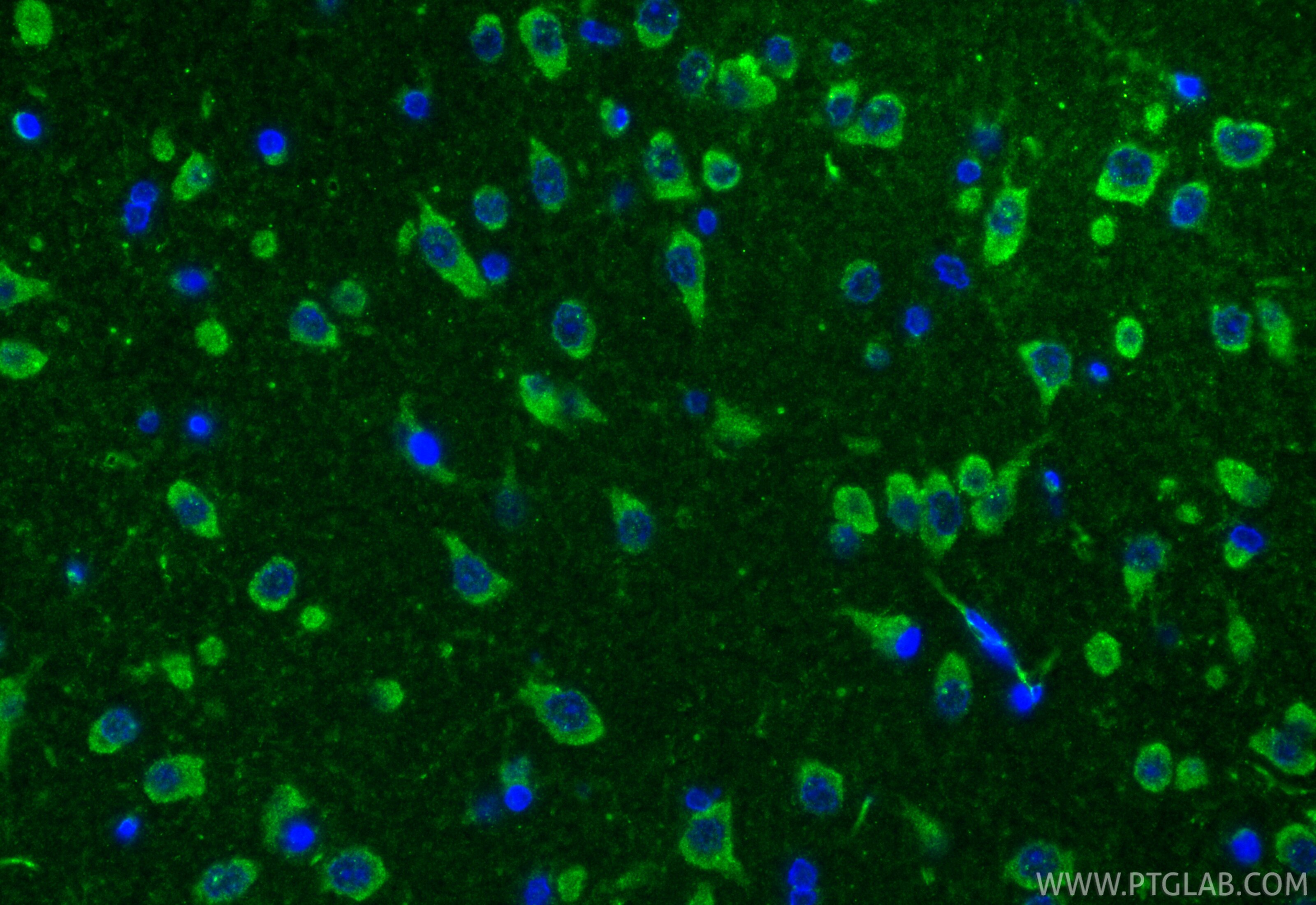 CRH/CRF antibody (26848-1-PBS) | Proteintech