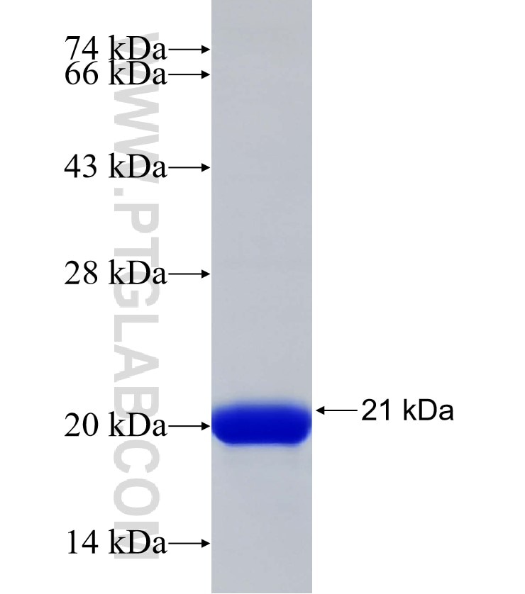 CRTAC1 Fusion Protein Ag32943 | Proteintech