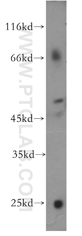 CSF2RA/CD116 antibody (18307-1-AP) | Proteintech