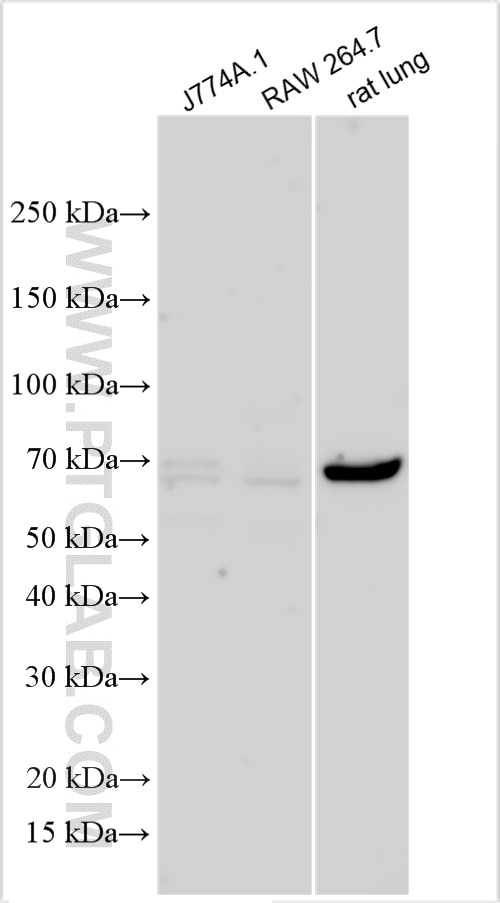 CSF2RA/CD116 antibody (32058-1-AP) | Proteintech