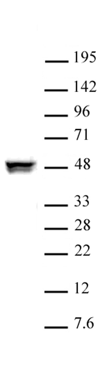 CTBP2 antibody (pAb) | Proteintech