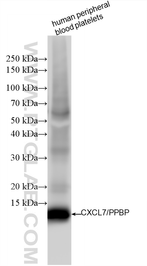 CXCL7/PPBP antibody (86698-1-PBS) | Proteintech