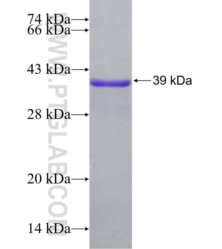 CYR61 Fusion Protein Ag30753 | Proteintech