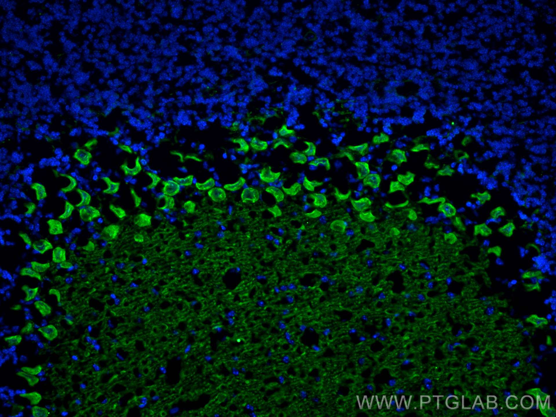 Calbindin-D28k antibody (66394-1-Ig) | Proteintech