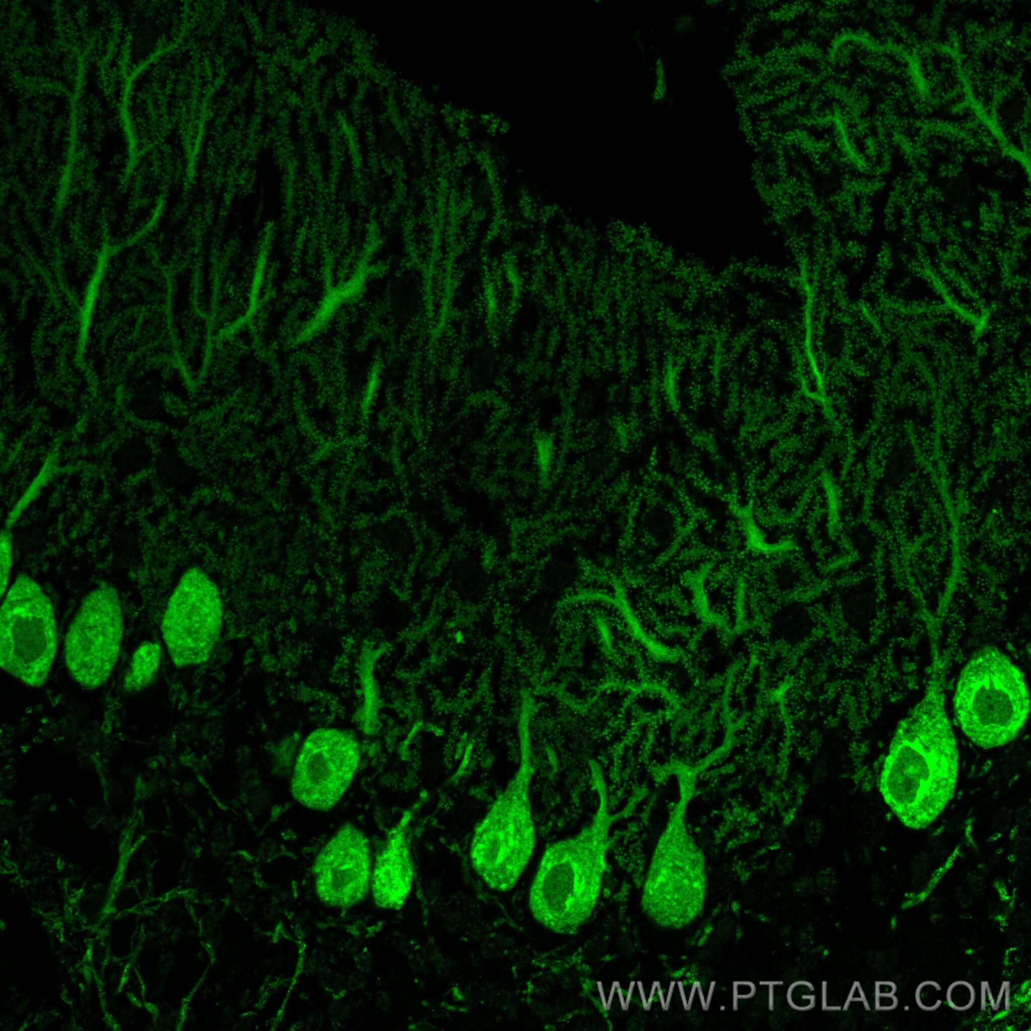 Calbindin-D28k antibody (CL488-66394) | Proteintech