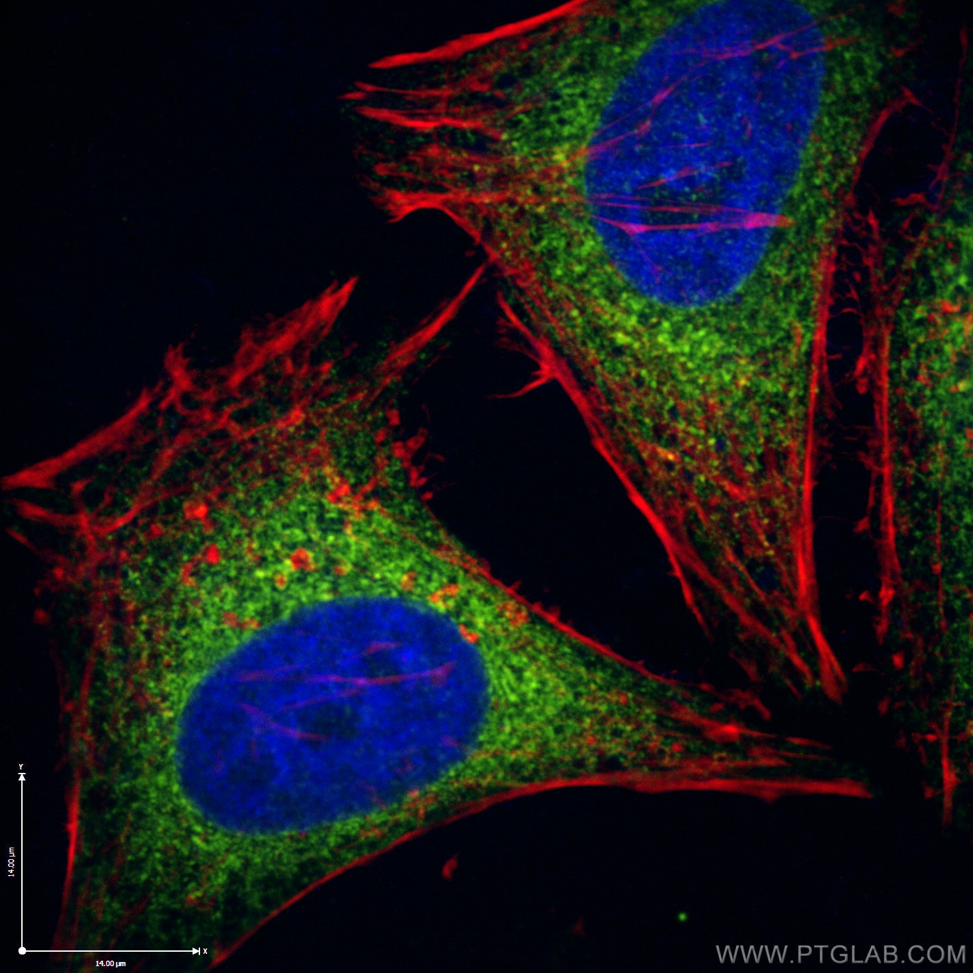 Calreticulin antibody (27298-1-AP) | Proteintech