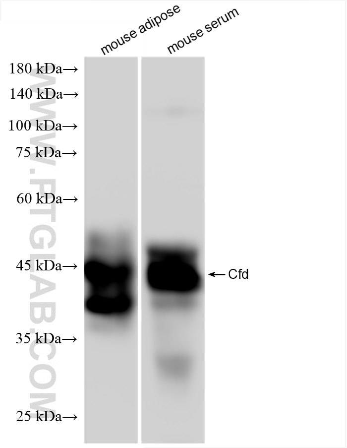 Complement factor D antibody (85643-4-RR) | Proteintech
