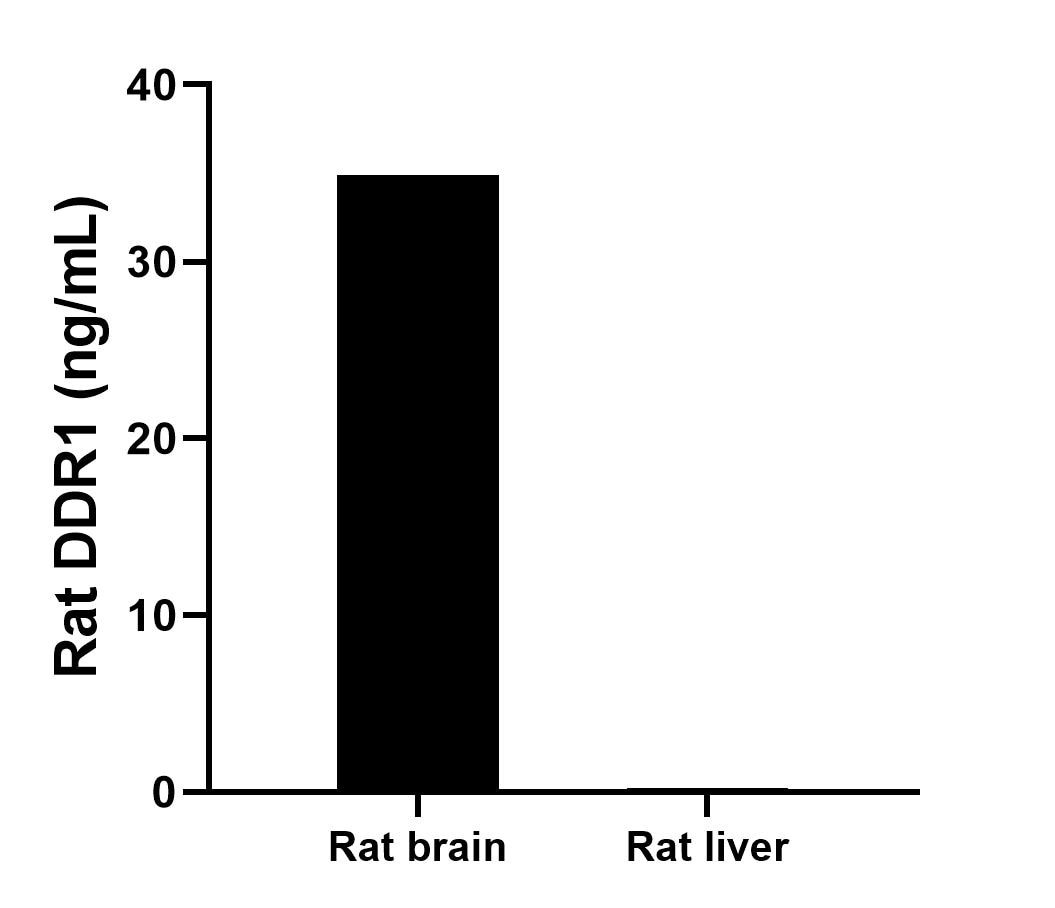DDR1 antibody (86819-2-PBS) | Proteintech
