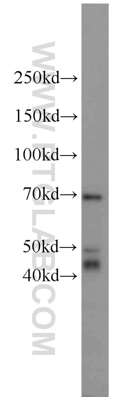DARS2 antibody (13807-1-AP) | Proteintech