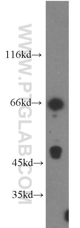 DARS2 antibody (13807-1-AP) | Proteintech