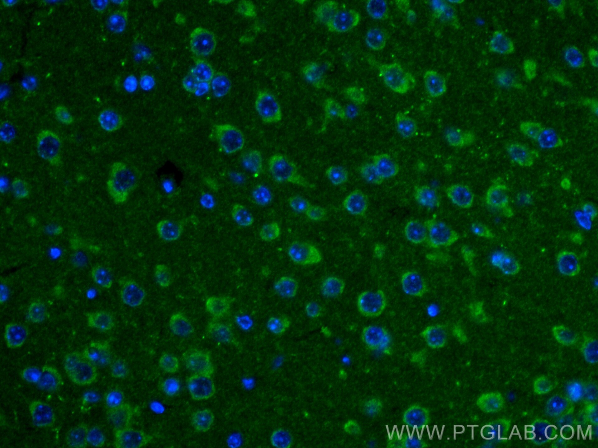 DCX antibody (13925-1-AP) | Proteintech