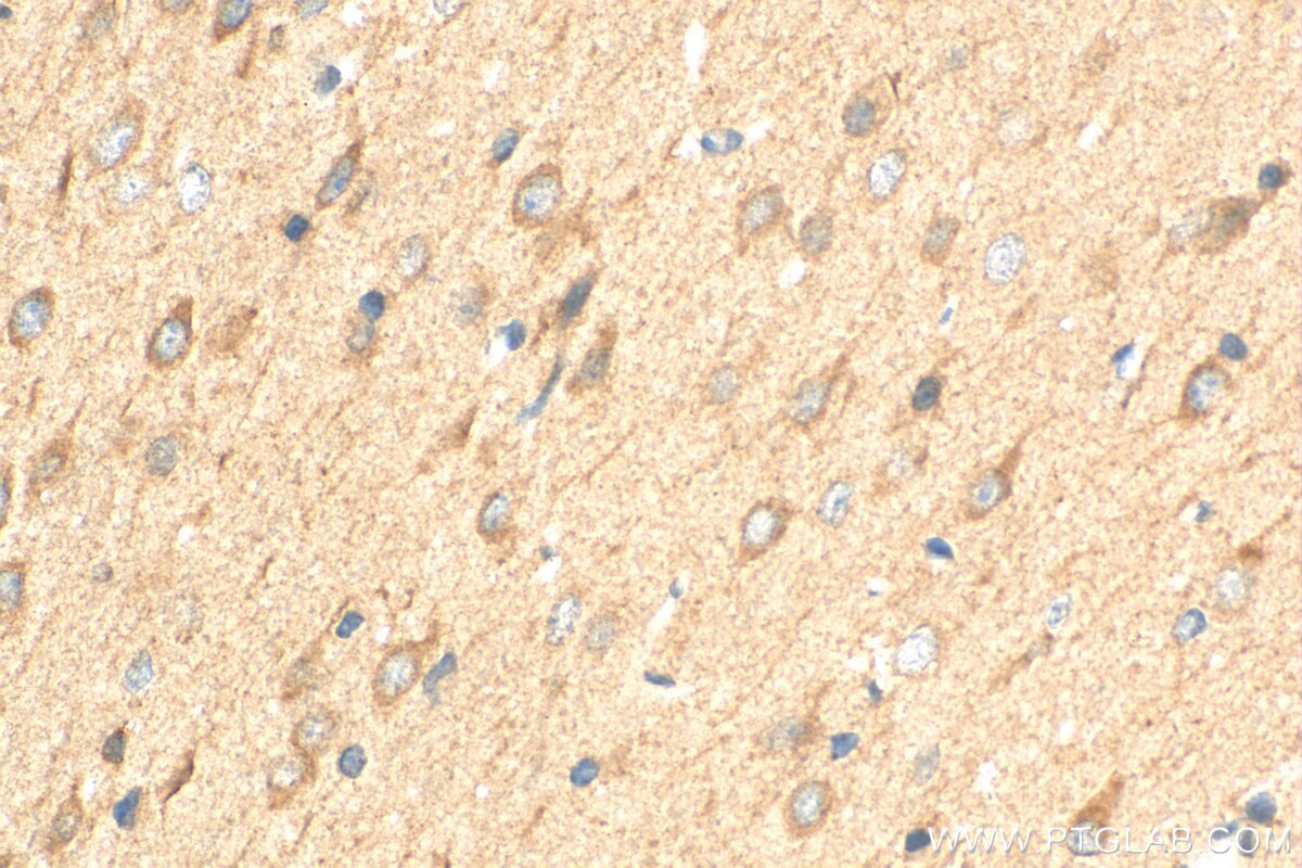 DCX antibody (13925-1-AP) | Proteintech