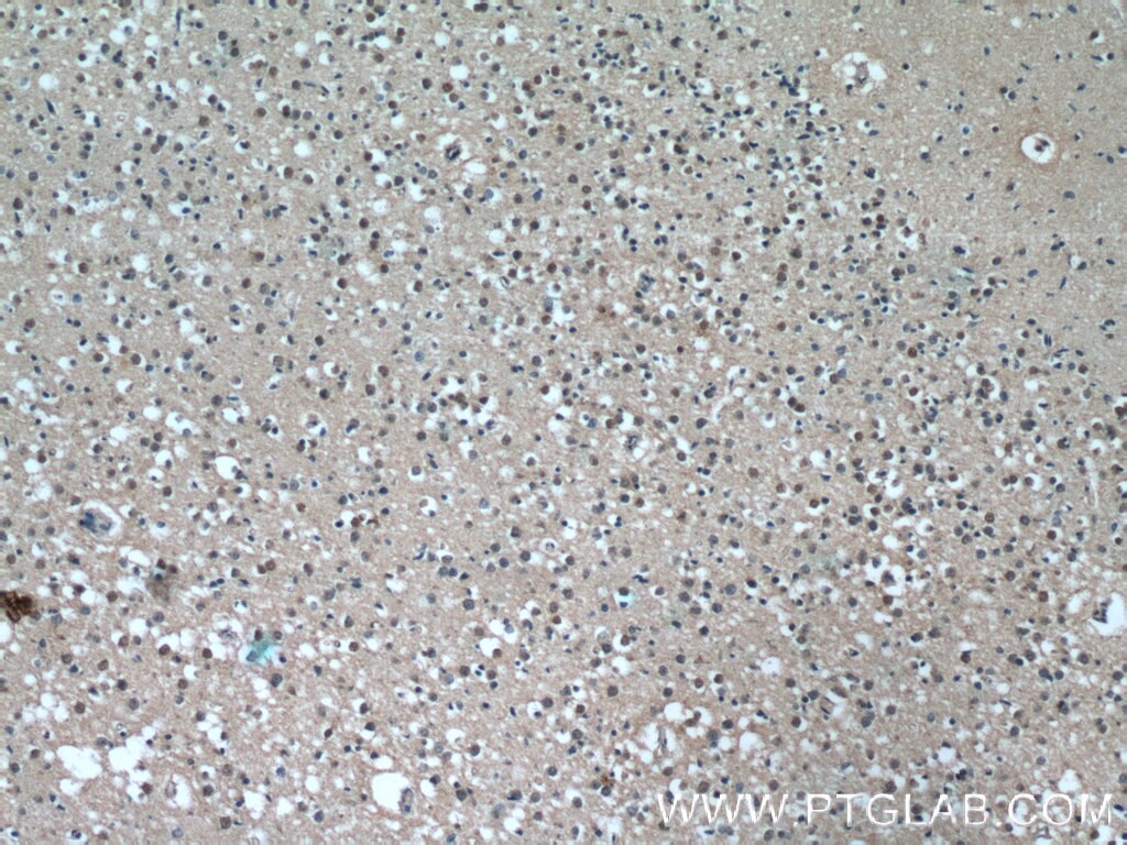 DEK Fusion Protein Ag8225 | Proteintech