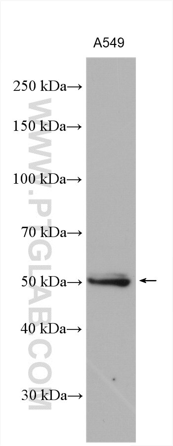DFNA5/GSDME antibody (13075-1-AP) | Proteintech