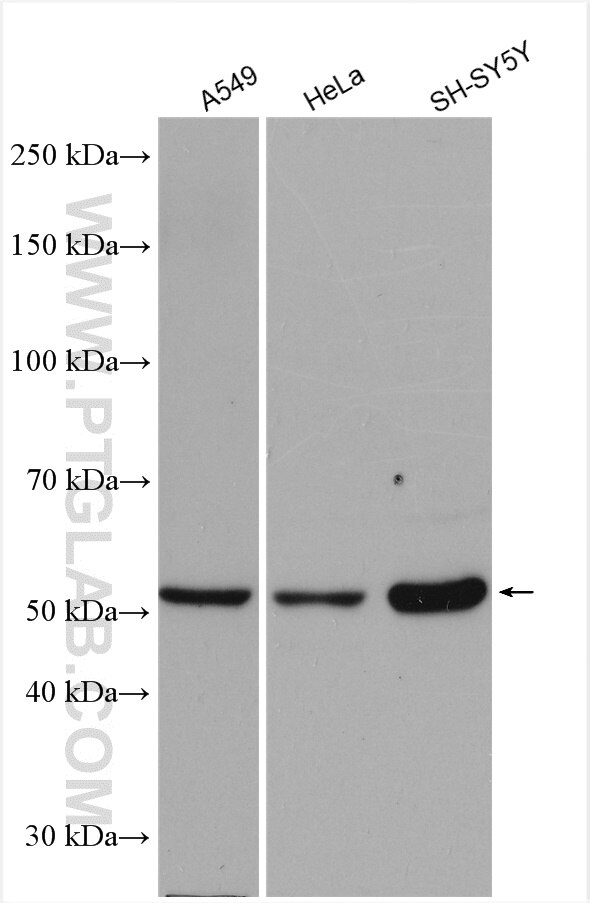 DFNA5/GSDME antibody (13075-1-AP) | Proteintech